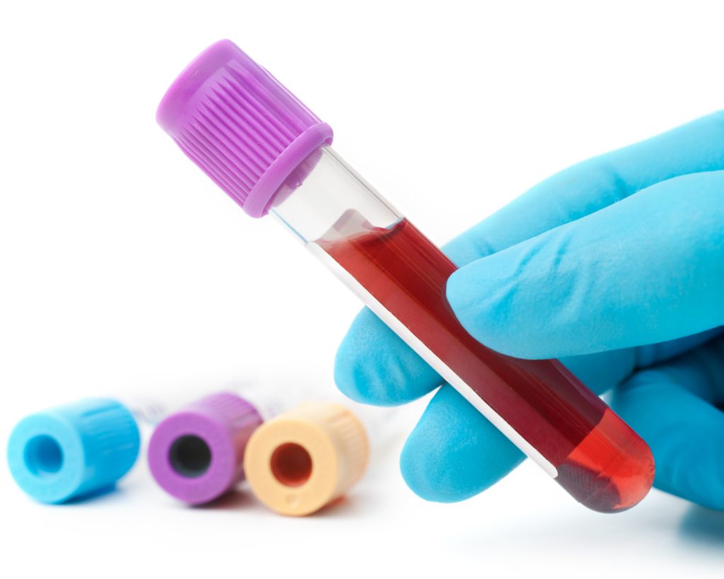 Labordiagnostik - Holubova